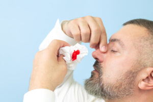 Nosebleed in Winters: Causes, Prevention, and When to Seek Help - Dr ...